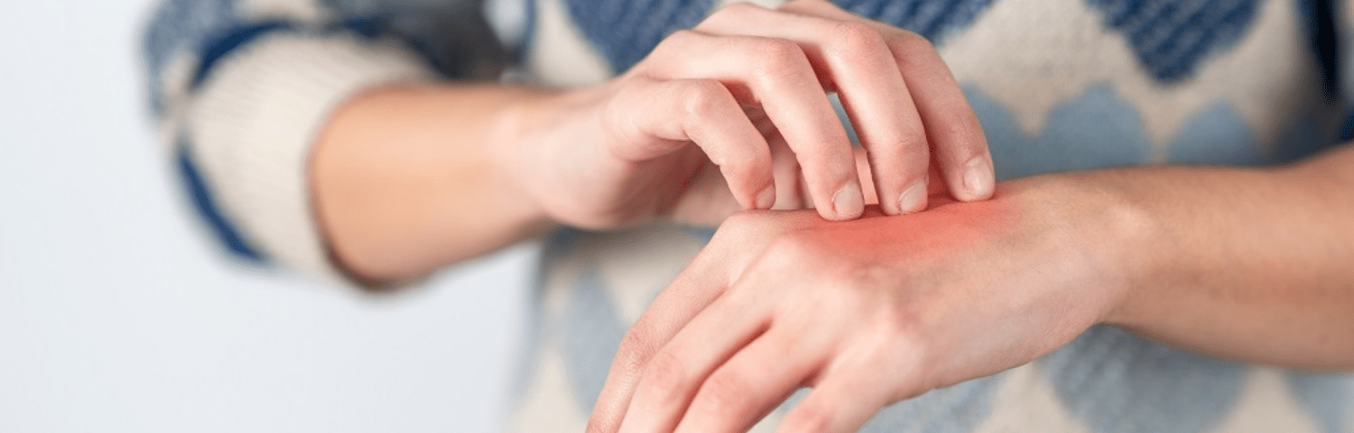 Is an itchy wound a sign of healing? | Elastoplast UK